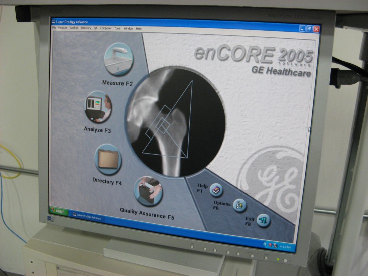 GE Lunar Prodigy Advance | RSTI Exchange – Engineered for Life