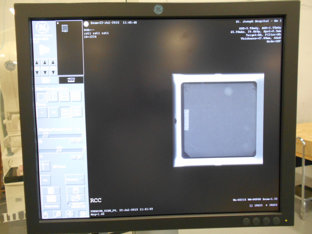 GE Senographe DS | RSTI Exchange – Engineered for Life