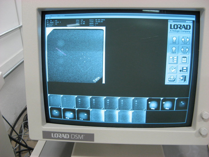 Lorad Multicare Biopsy System | RSTI Exchange – Engineered for Life